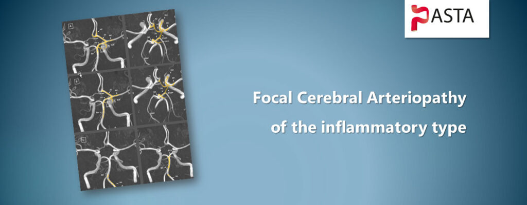 PASTA – Paediatric Arteriopathy Steroid Aspirin Trial